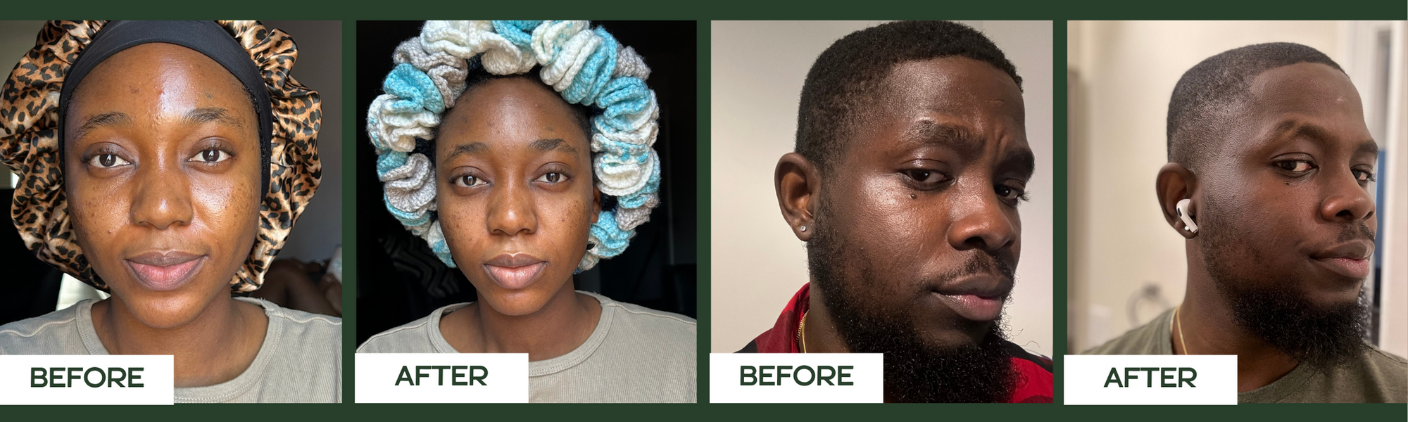 Alpha Glow Serum – Aurganics